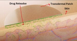 Transdermal Patches: Working, advantages, applications, and types ...